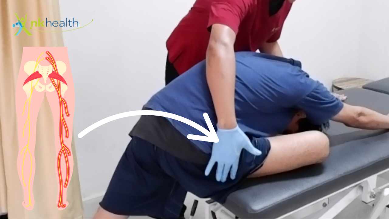 Atasi Nyeri Saraf Sciatica dengan Fisioterapi